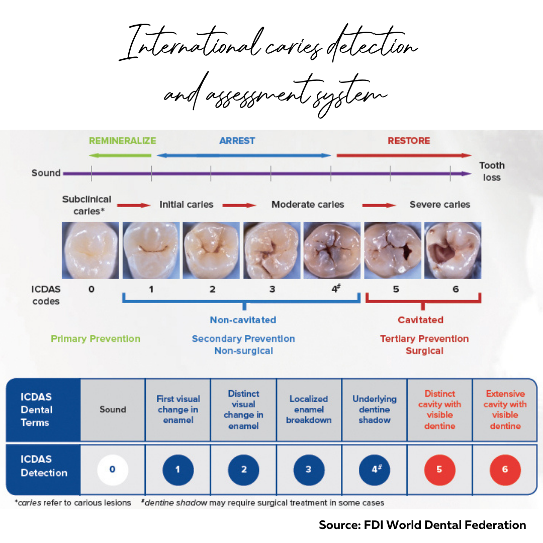 The selective carious tissue removal approach • Deppeler SA